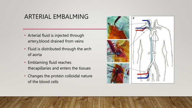 embalming introduction and types anatomy | PPTX | First Aid | Injuries