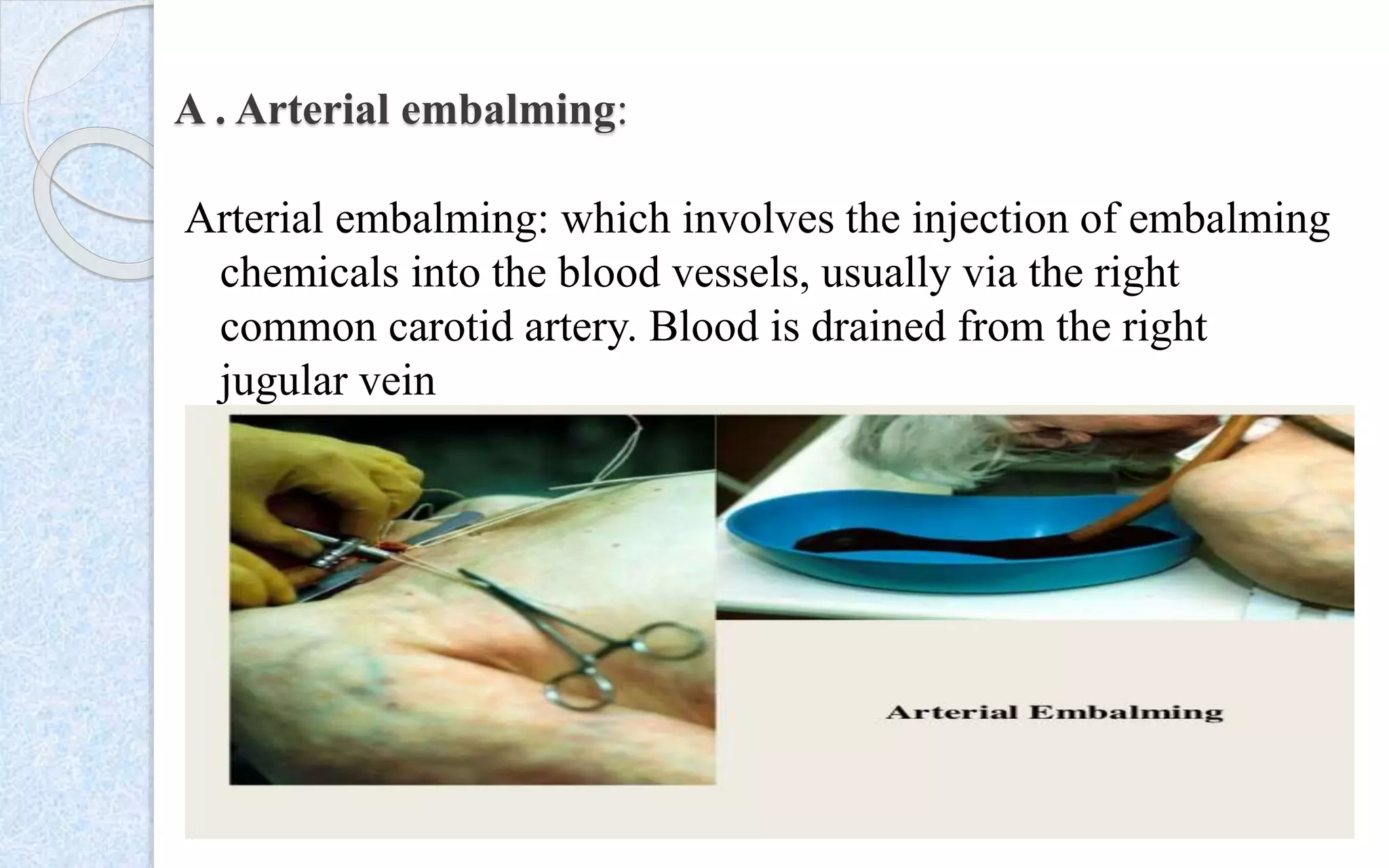 EMBALMING 12.11.22.pptx