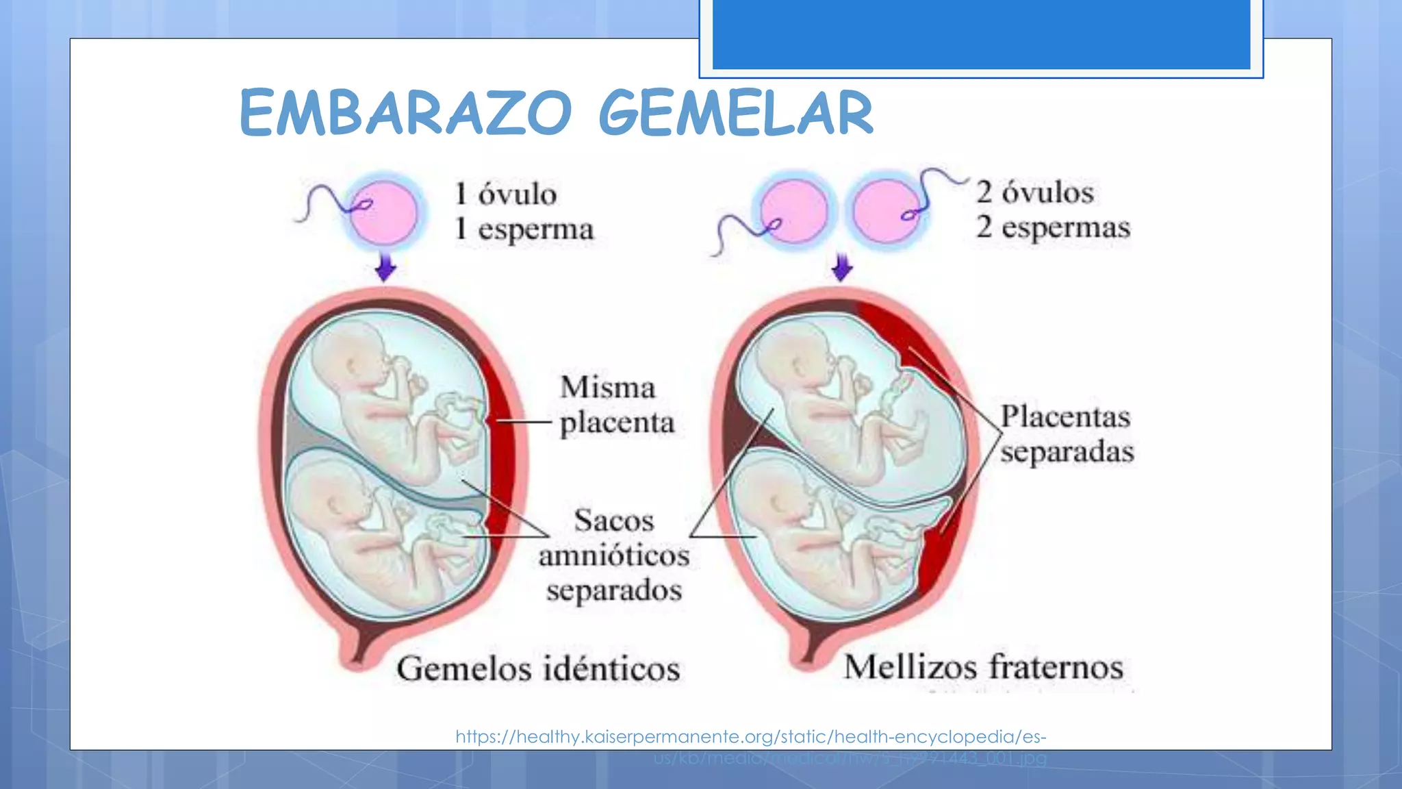 Embarazo gemelar | PPTX | Pregnancy | Reproductive Health