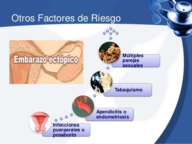 Embarazo Ectopico