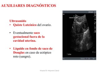 Embarazo Ectopico | PPTX