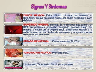 Embarazo Ectopico Cuidados de enfermería | PPSX