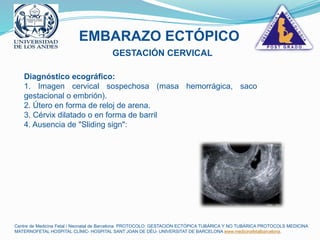 Embarazo ectopico ginecologia y obstetricia | PPTX