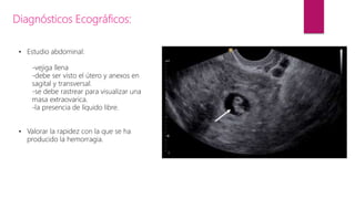 Embarazo ectópico | PPTX