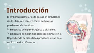 Embarazo Gemelar Embriología, desarrollo | PPTX