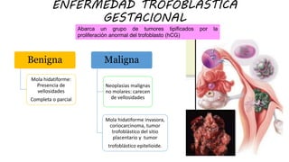 Embarazo molar | PPTX