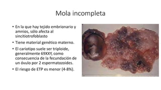 Embarazo molar.pptx