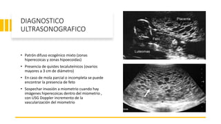 EMBARAZO MOLAR.pptx