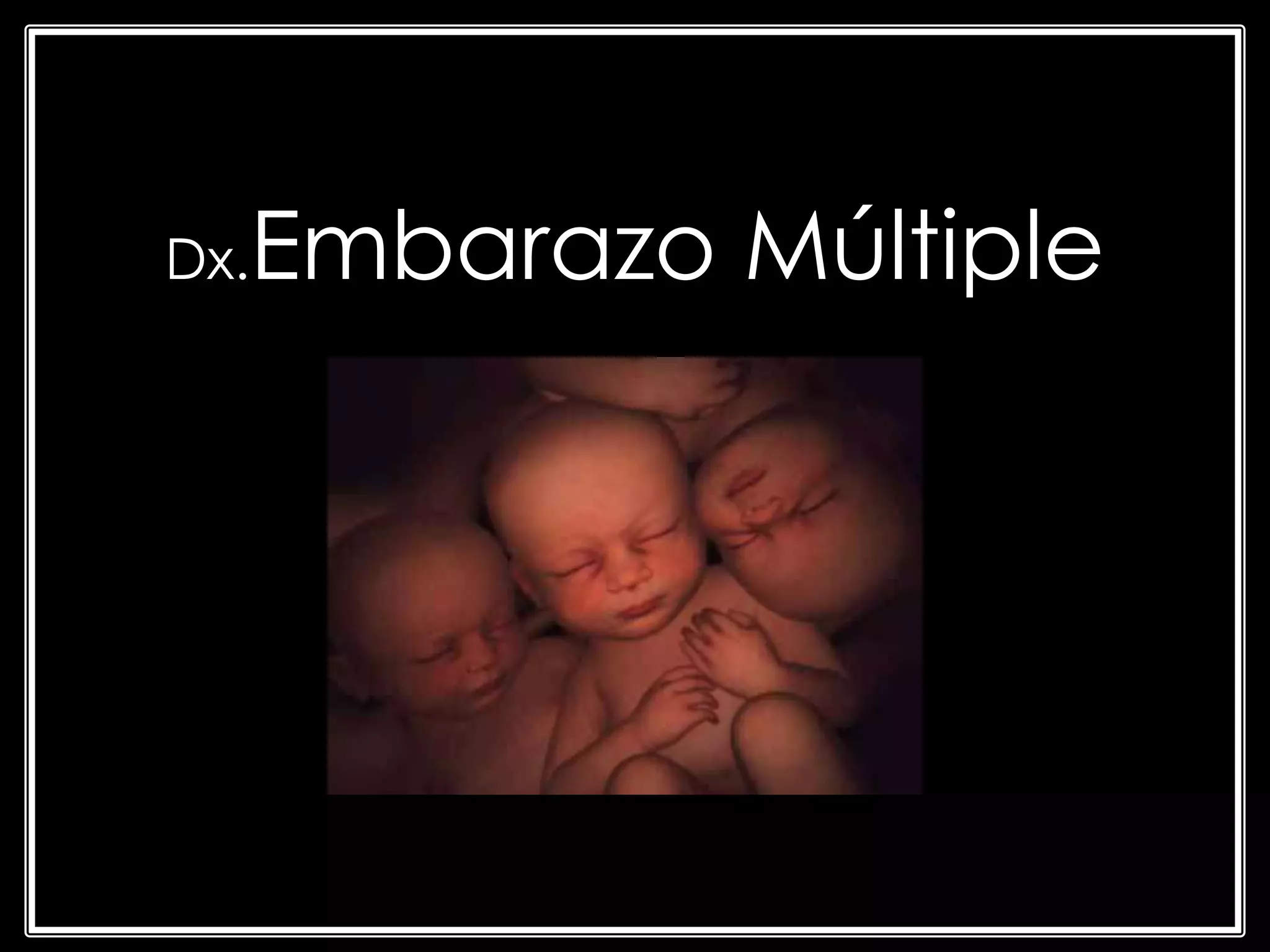 diagnostico del Embarazo multiple | PPT