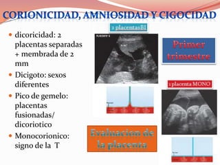 Embarazo multiple | PPTX