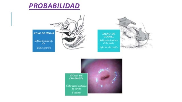 Embarazo normal dx,,evolución,control 3 y4