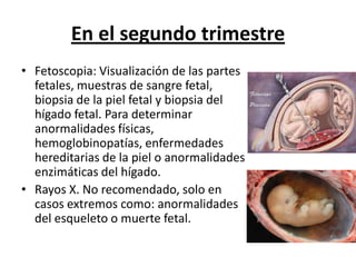 Embarazo normoevolutivo | PPTX