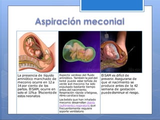 Embarazo postermino | PPT