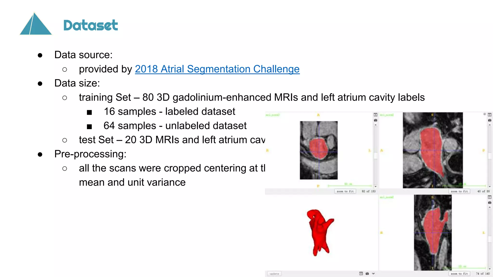 [EMBC 2021] Hierarchical Consistency Regularized Mean Teacher for Semi-supervised 3D Left Atrium ...