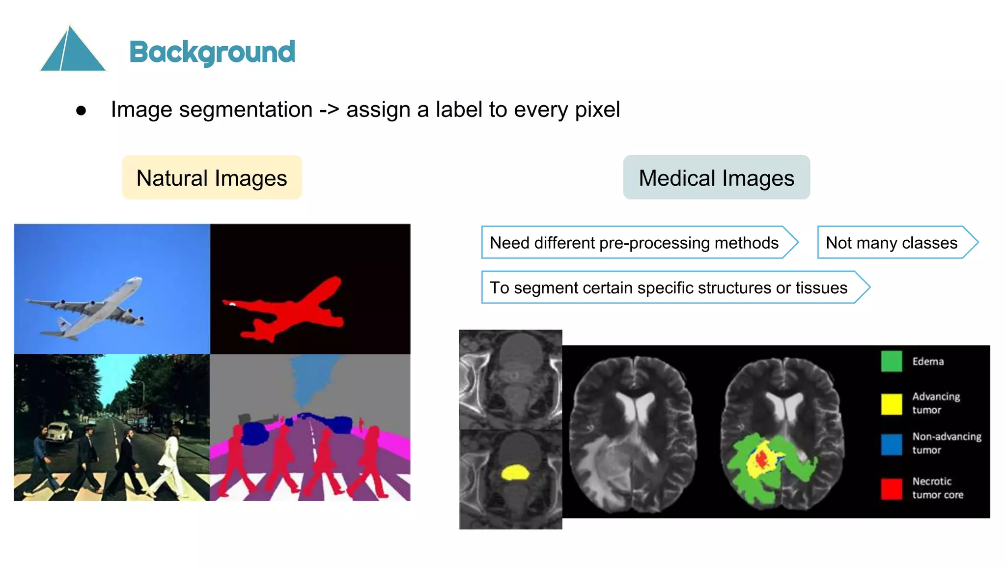 [EMBC 2021] Hierarchical Consistency Regularized Mean Teacher for Semi-supervised 3D Left Atrium ...