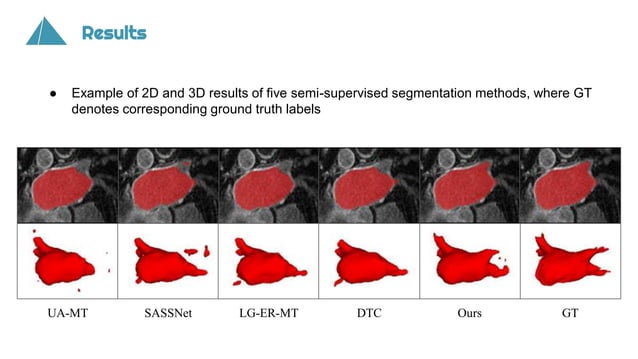[EMBC 2021] Hierarchical Consistency Regularized Mean Teacher for Semi-supervised 3D Left Atrium ...