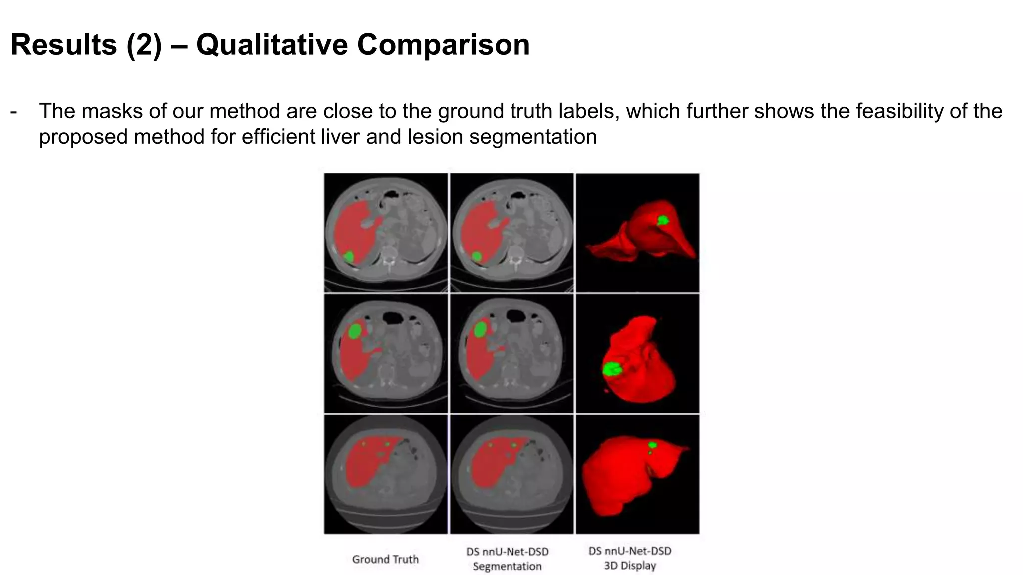 [EMBC 2021] Multi Slice Dense Sparse Learning for Efficient Liver and Tumor Segmentation | PPTX