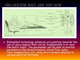 Embedded system-in-automobile | PPTX