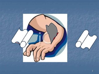 Embedded objects | PPTX | First Aid | Injuries