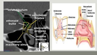 EMBERYOLOGY AND ANATOMY OF EXTERNAL NOSE.pptx