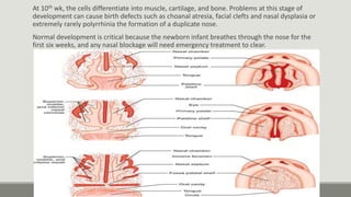 EMBERYOLOGY AND ANATOMY OF EXTERNAL NOSE.pptx