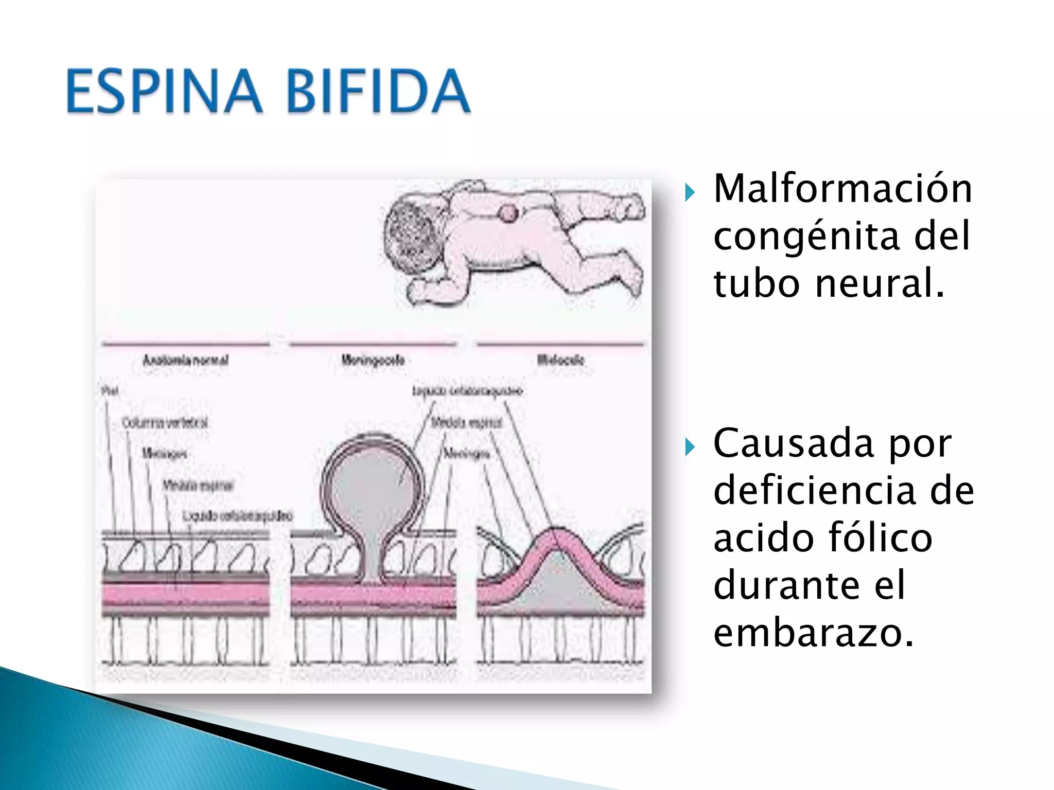 Embiologia Formacion del Tubo Neural | PPTX
