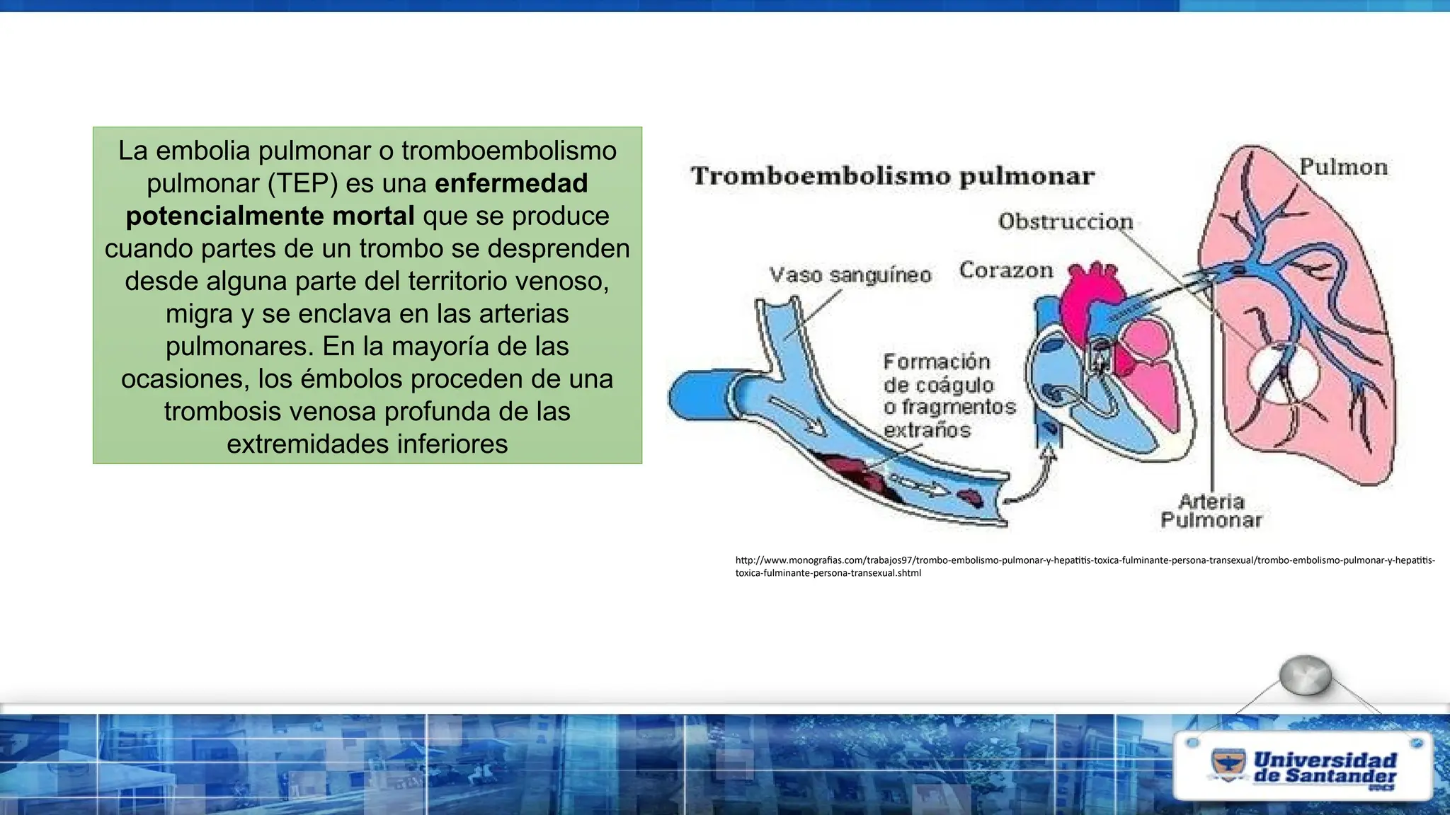 enfermemedad de EMBOLIA PULMONAR vias respiratorias | PDF