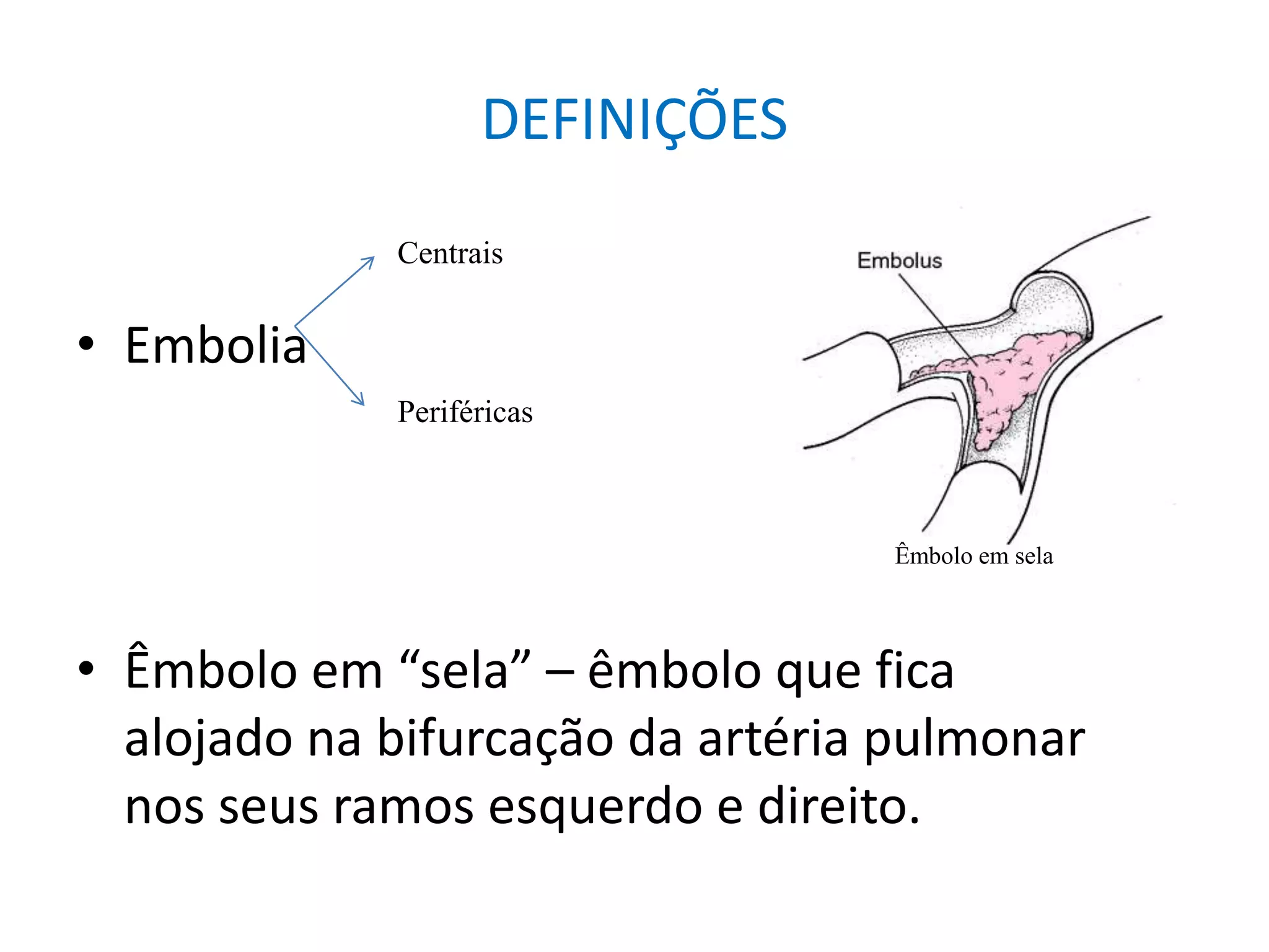 Embolia pulmonar - diagnóstico e tratamento | PPTX