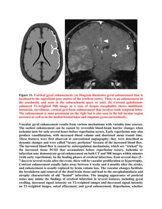 Radiological pathology of embolic infarctions | PDF