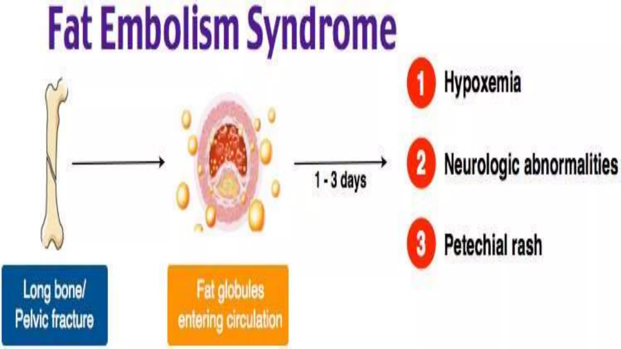 Embolism | PPTX