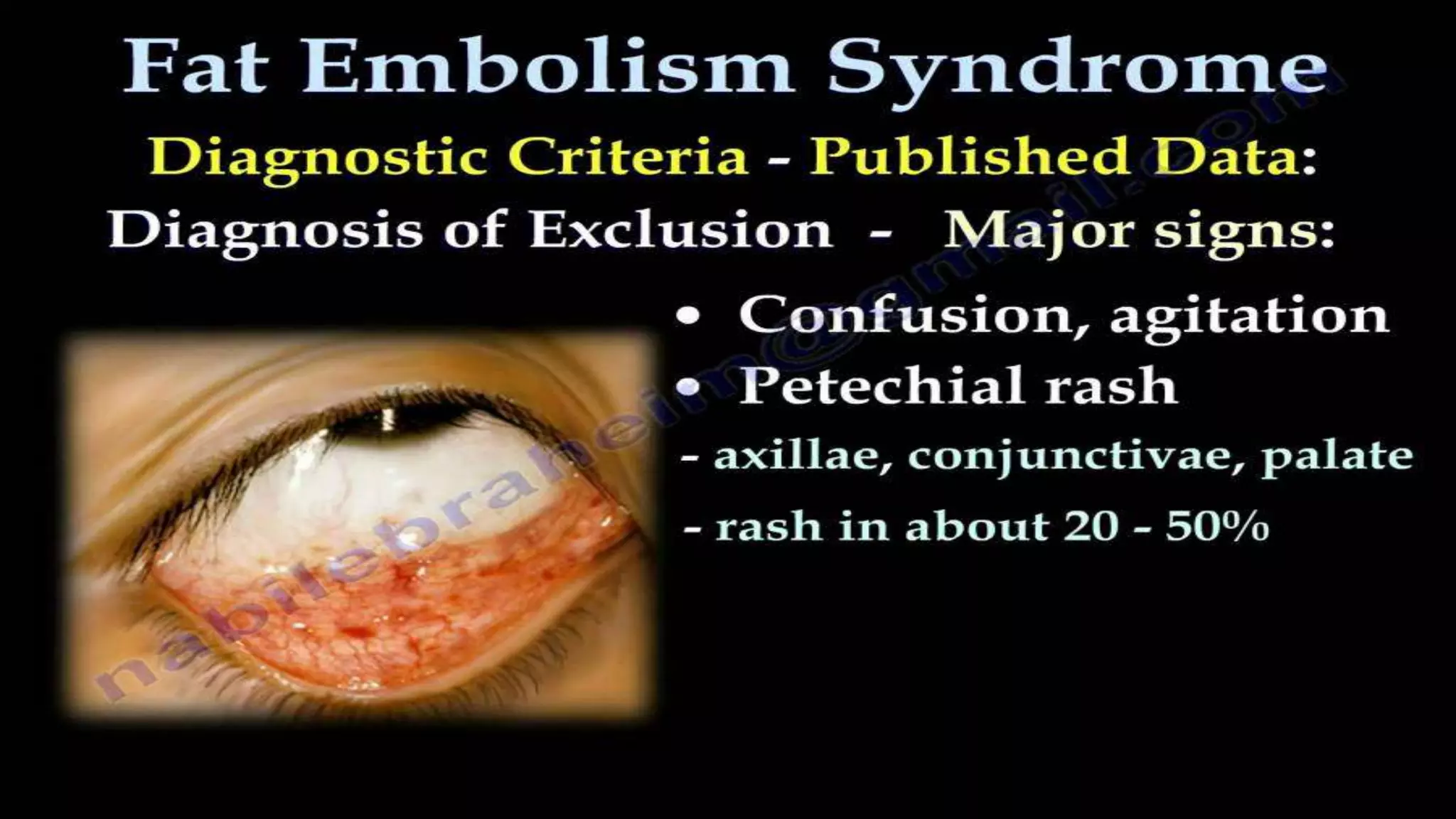 Embolism | PPTX