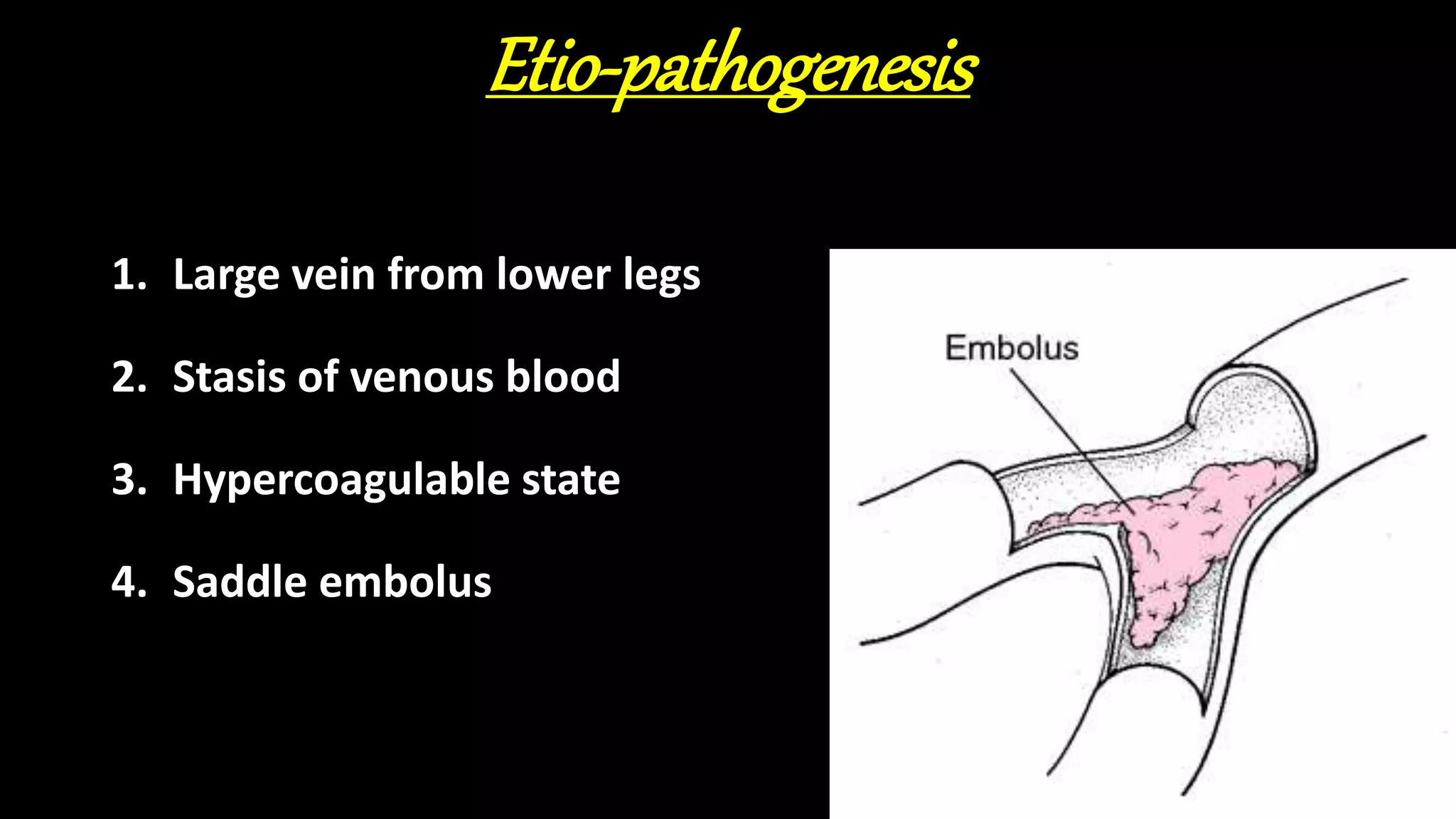 Embolism | PPTX