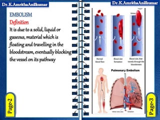 Embolism by Dr.AmrithaAnilkumar | PPTX