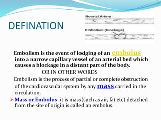 EMBOLISM.pptx