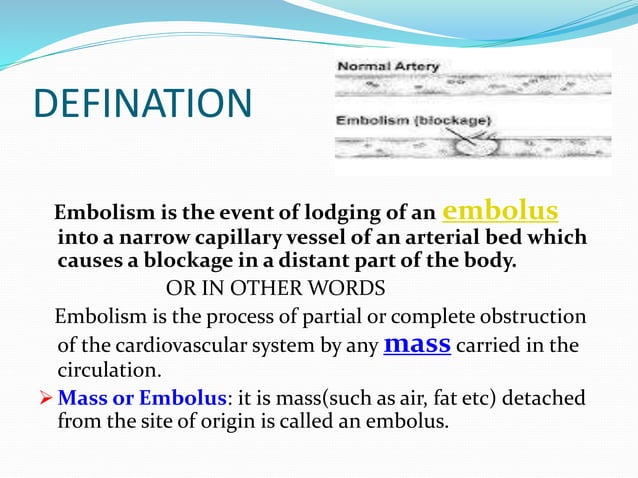 EMBOLISM.pptx