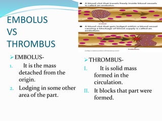 EMBOLISM.pptx