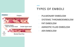 Embolism.pptx powerpoint pathology ppts | PPTX