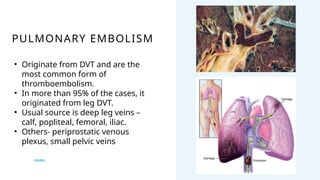 Embolism.pptx powerpoint pathology ppts | PPTX