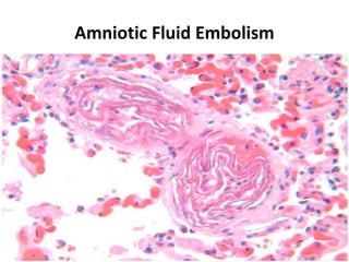 Embolism & Hemorrhage.pptx
