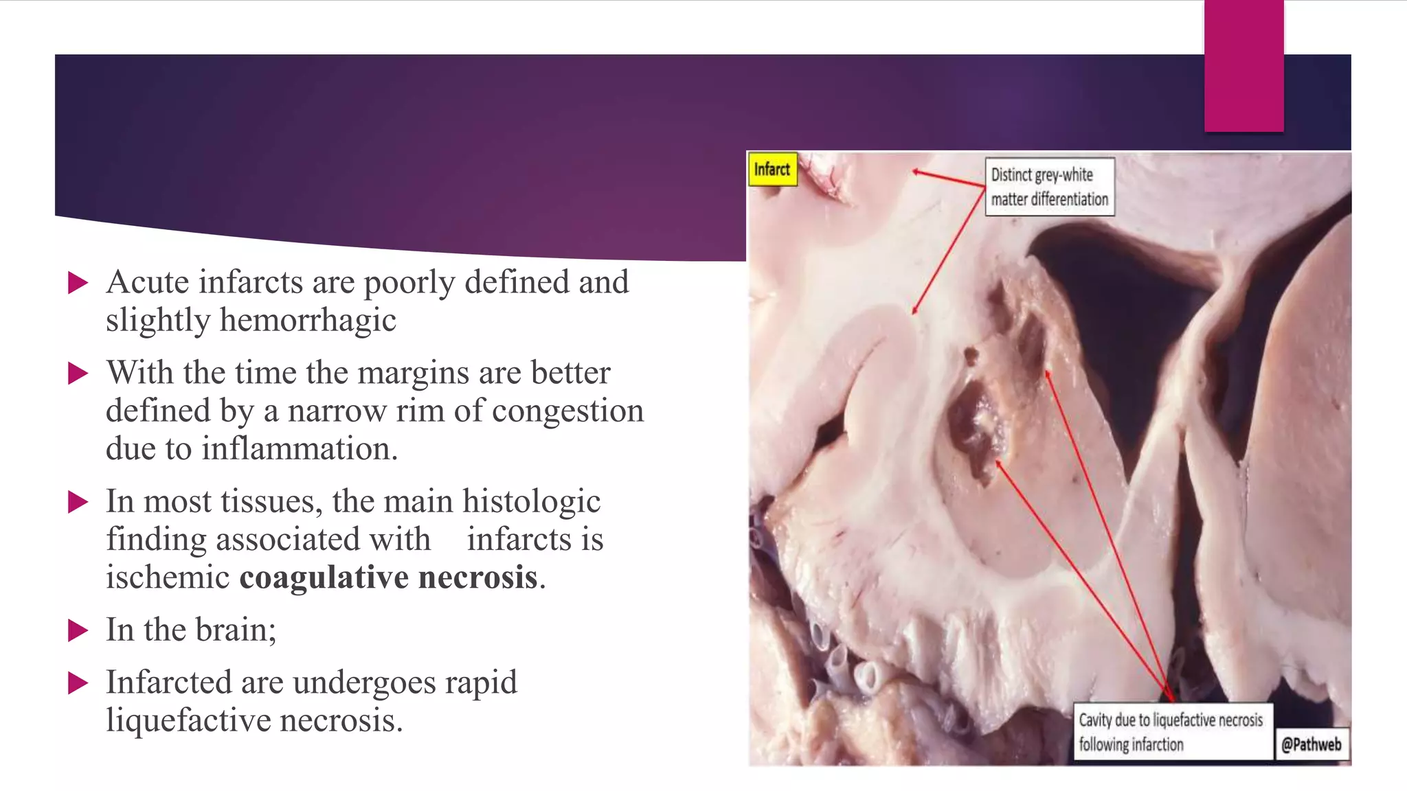 Embolism, Infarction and Shock ppt-1 slides.pptx