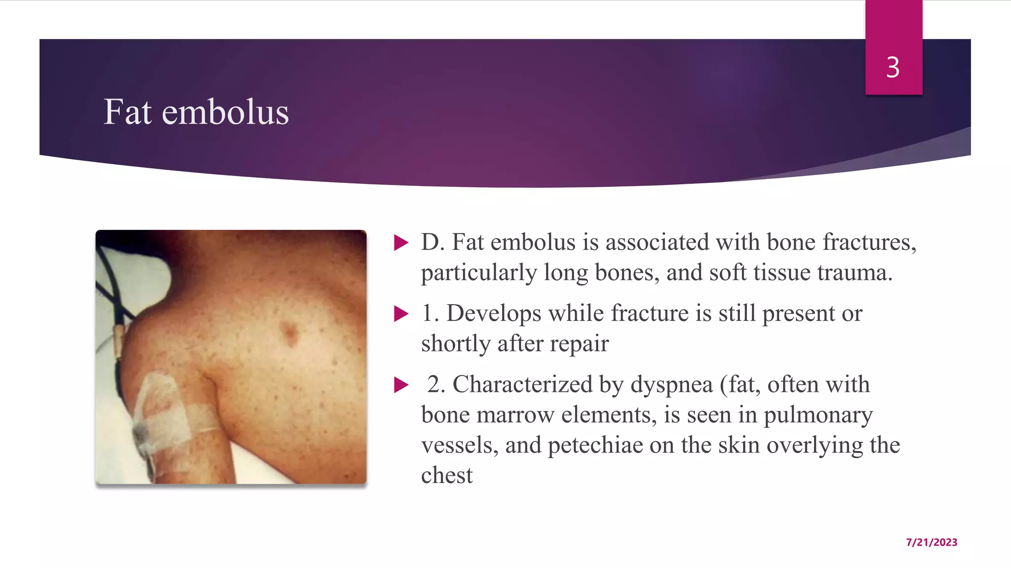 Embolism, Infarction and Shock ppt-1 slides.pptx