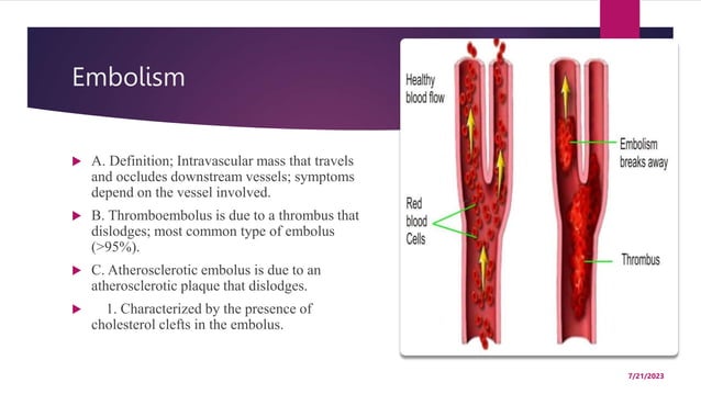 Embolism, Infarction and Shock ppt-1 slides.pptx