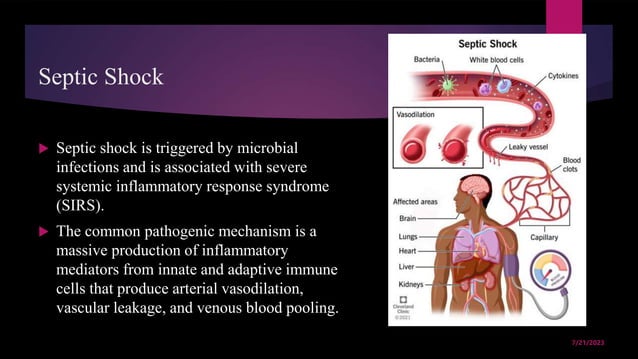 Embolism, Infarction and Shock ppt-1 slides.pptx