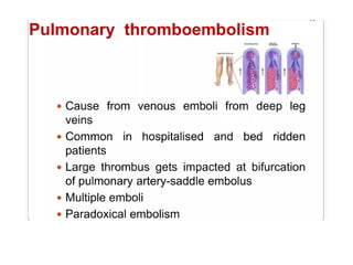 embolism, inf EMBOLISM,ISCHAEMIA AND INFARCTION.ppt