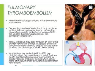 embolism, inf EMBOLISM,ISCHAEMIA AND INFARCTION.ppt