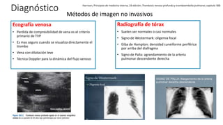 Embolismo pulmonar | PPTX