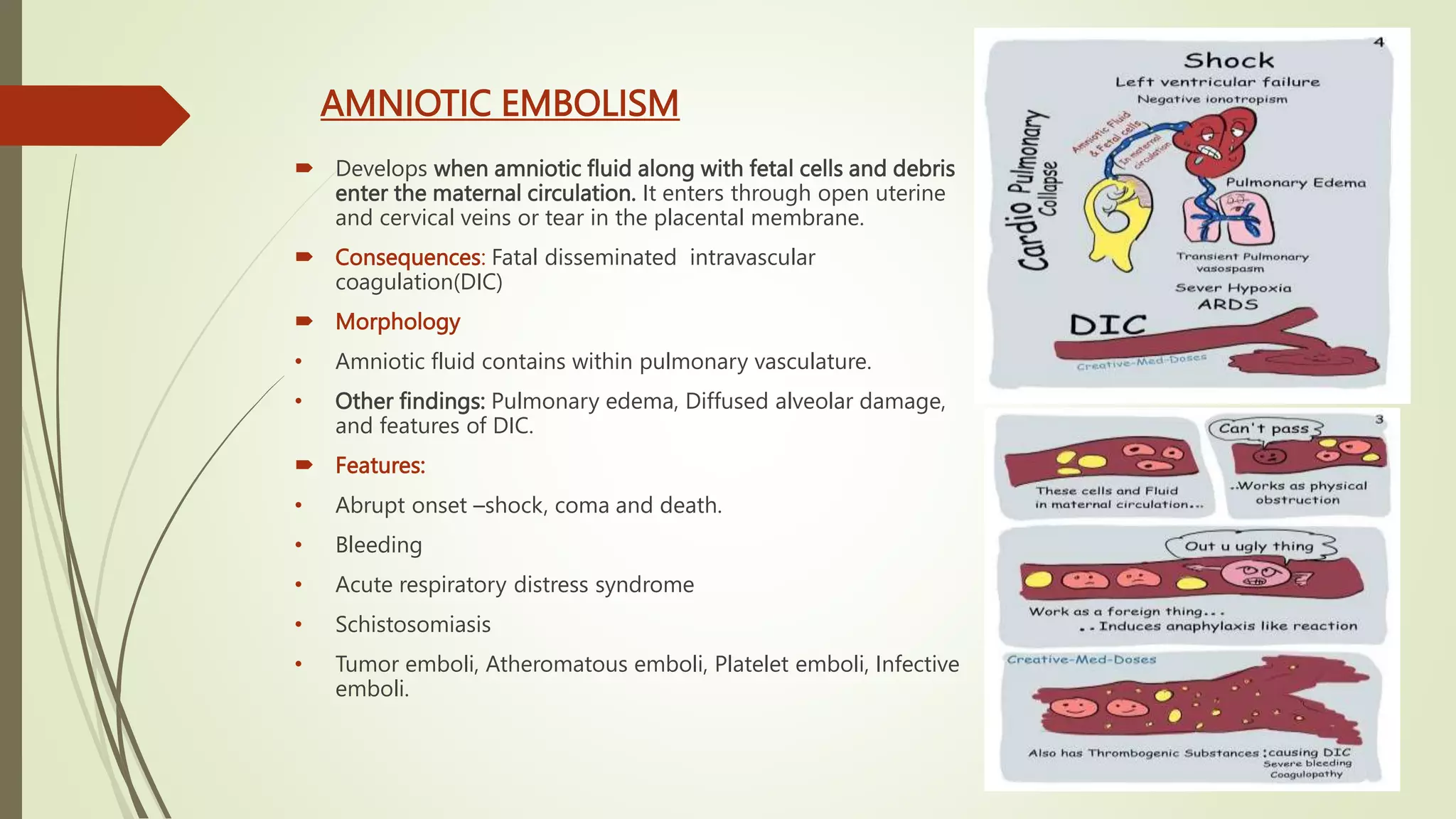 embolism ppt.pptx