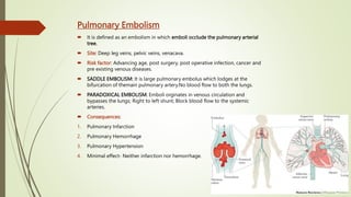 embolism ppt.pptx