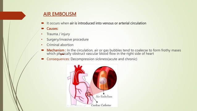 embolism ppt.pptx