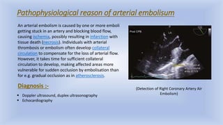 Embolisum | PPTX